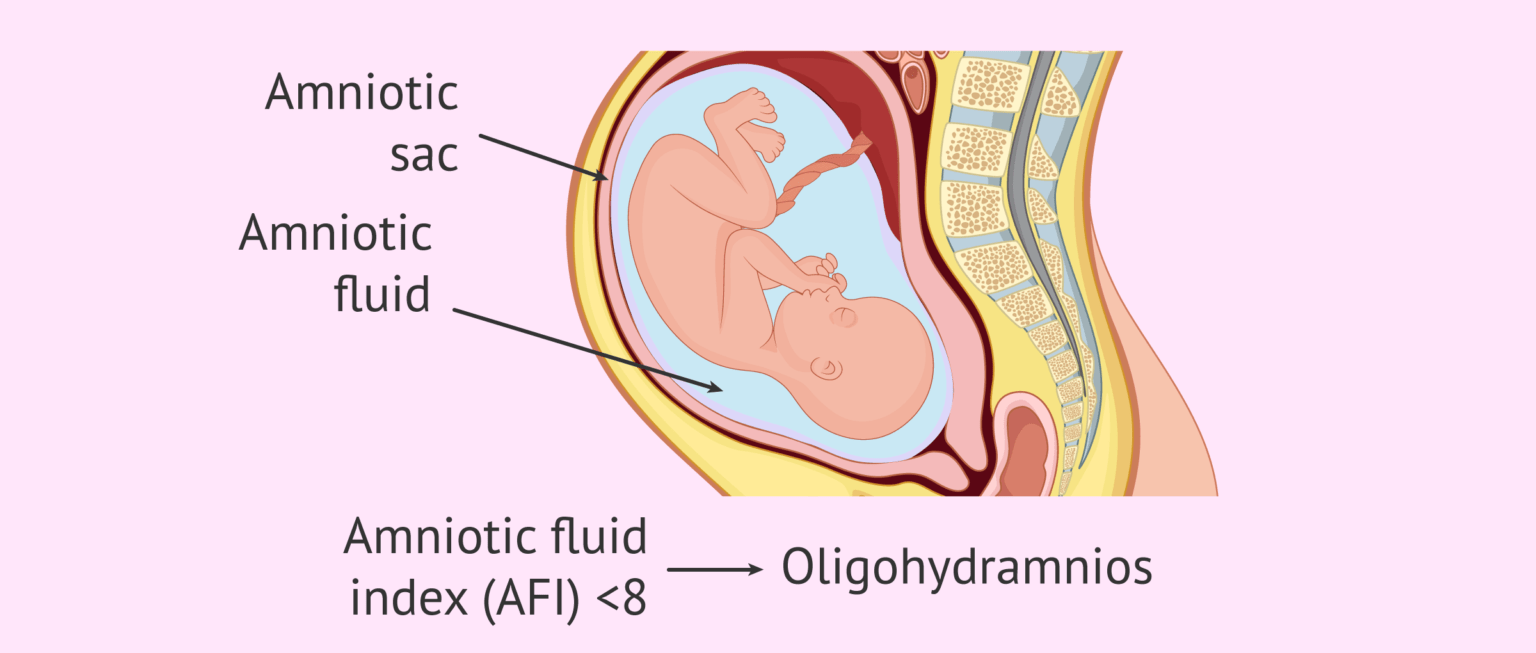 Amniotic Fluid: The Role in Ensuring Healthy Pregnancy - MyShishu